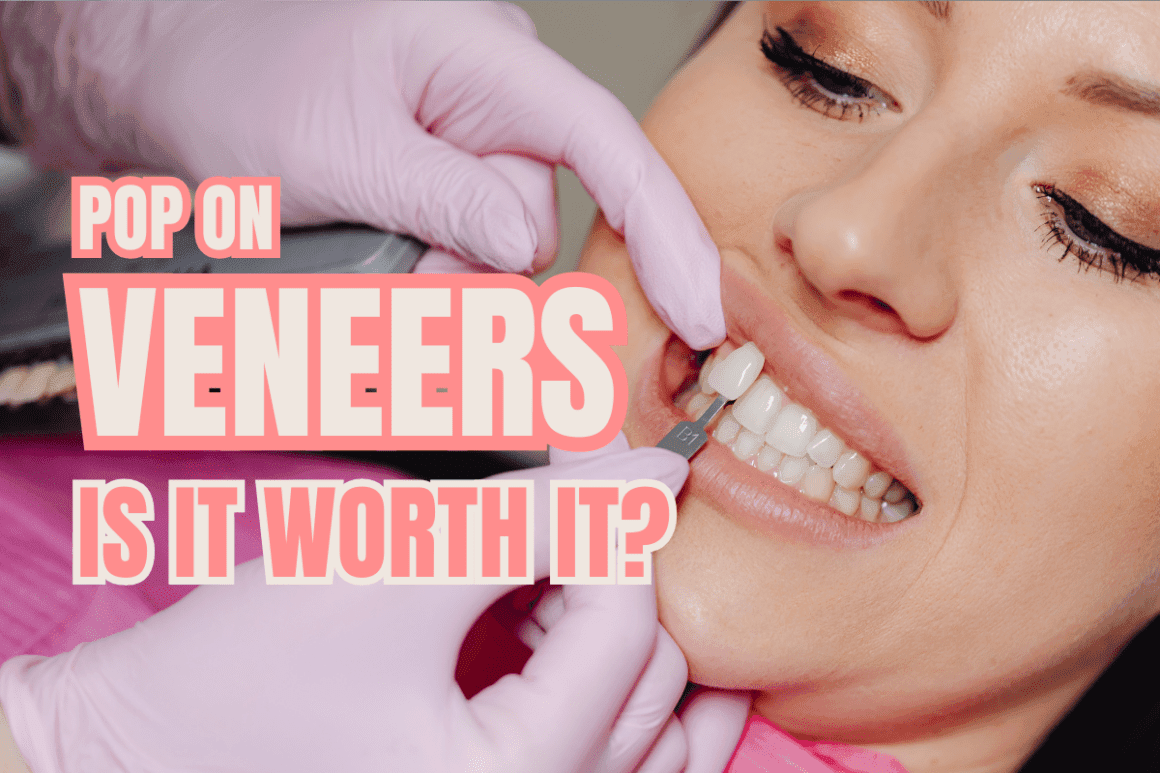 Pop On Veneers: The Quick Fix for Your Smile or a Temporary Solution?